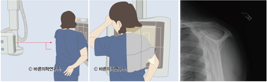 부위별 주요 X선 검사 - Metamedic