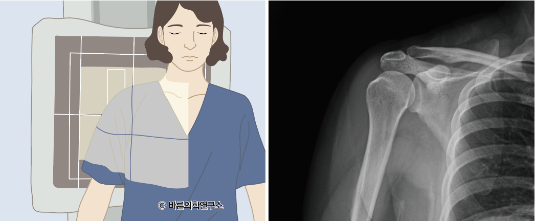 부위별 주요 X선 검사 - Metamedic