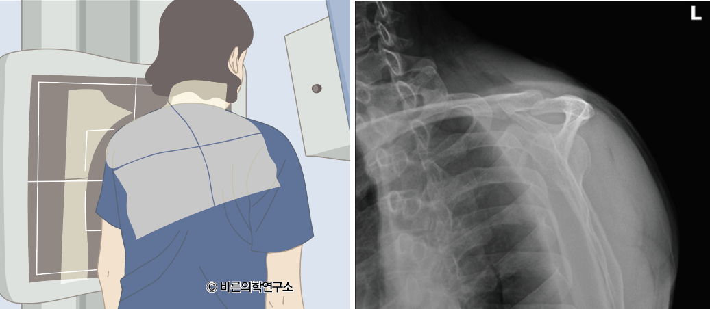 부위별 주요 X선 검사 - Metamedic
