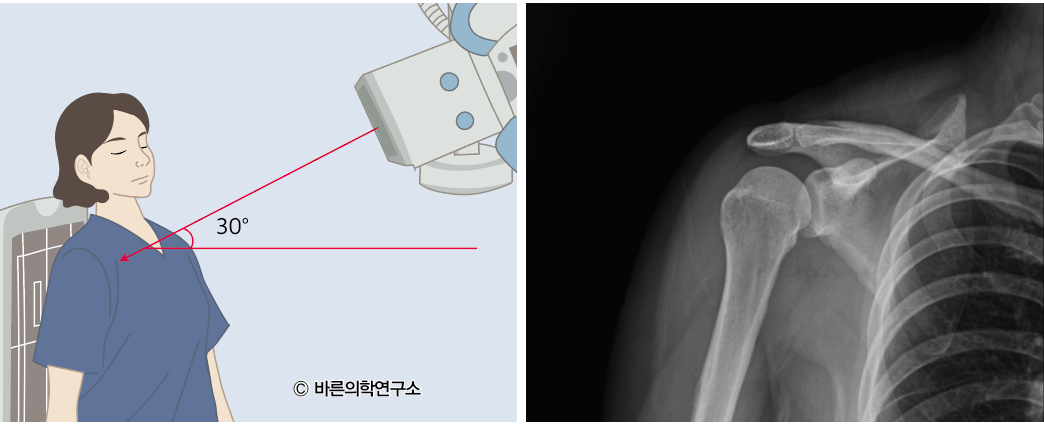 부위별 주요 X선 검사 - Metamedic