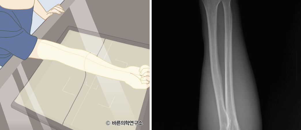 부위별 주요 X선 검사 - Metamedic