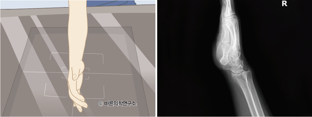 부위별 주요 X선 검사 - Metamedic