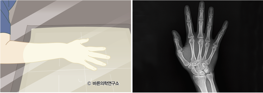 부위별 주요 X선 검사 - Metamedic