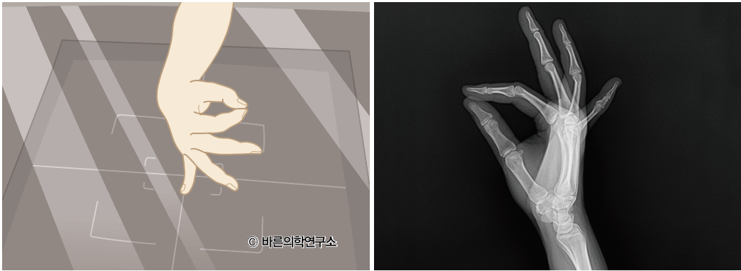 부위별 주요 X선 검사 - Metamedic