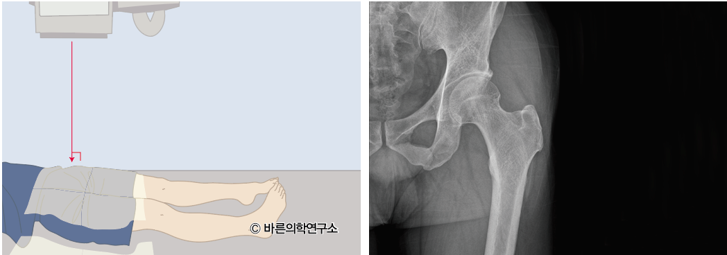 부위별 주요 X선 검사 - Metamedic