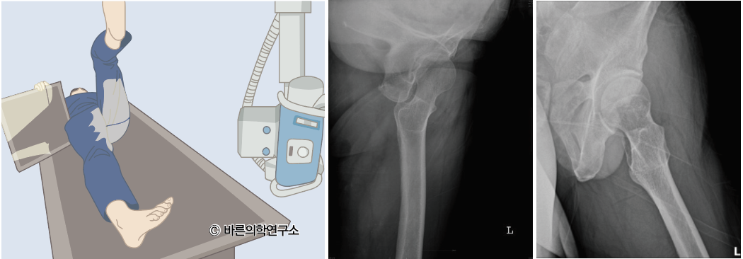 부위별 주요 X선 검사 - Metamedic