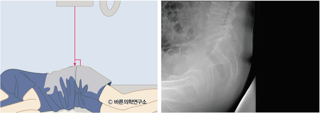 부위별 주요 X선 검사 - Metamedic