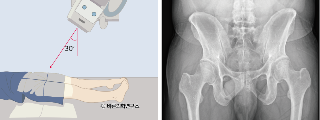부위별 주요 X선 검사 - Metamedic
