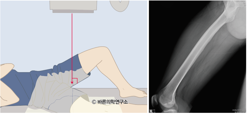 부위별 주요 X선 검사 - Metamedic