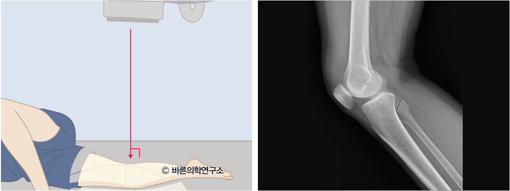 부위별 주요 X선 검사 - Metamedic