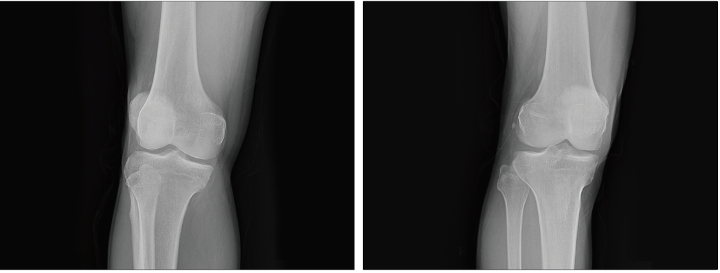 부위별 주요 X선 검사 - Metamedic