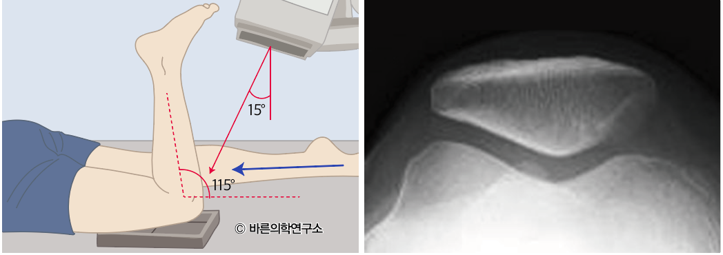 부위별 주요 X선 검사 - Metamedic