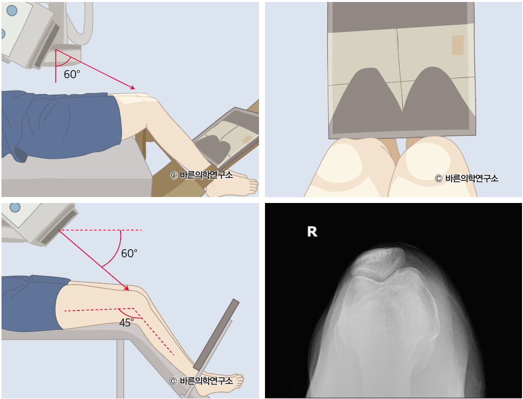 부위별 주요 X선 검사 - Metamedic