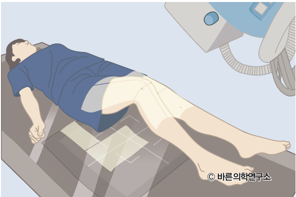 부위별 주요 X선 검사 - Metamedic