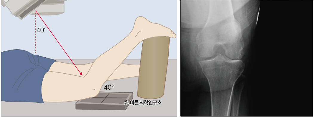 부위별 주요 X선 검사 - Metamedic