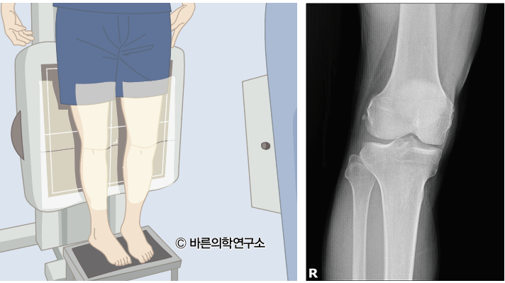 부위별 주요 X선 검사 - Metamedic