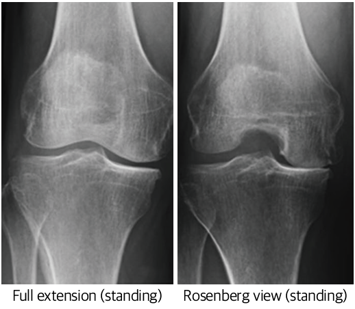 부위별 주요 X선 검사 - Metamedic