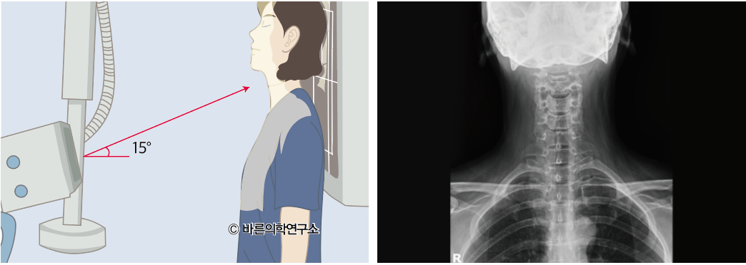 부위별 주요 X선 검사 - Metamedic
