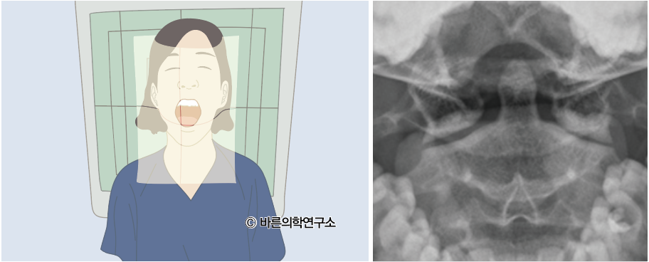 부위별 주요 X선 검사 - Metamedic