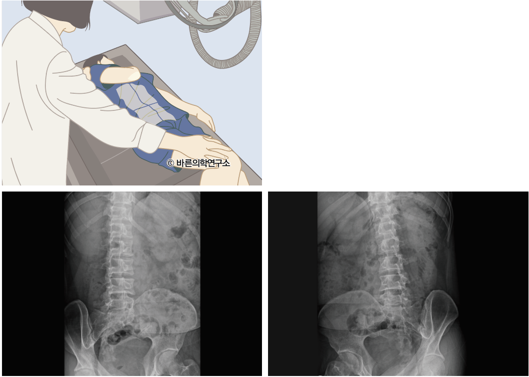 부위별 주요 X선 검사 - Metamedic