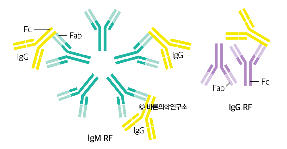 류마티스/자가면역 검사 - Metamedic