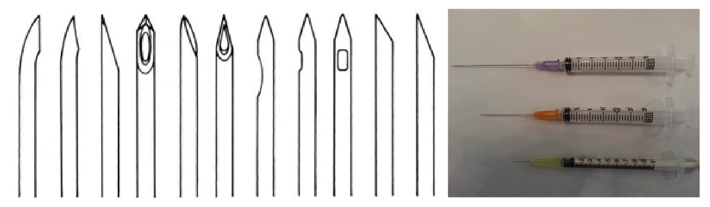 주사치료: 신경차단술 - Metamedic