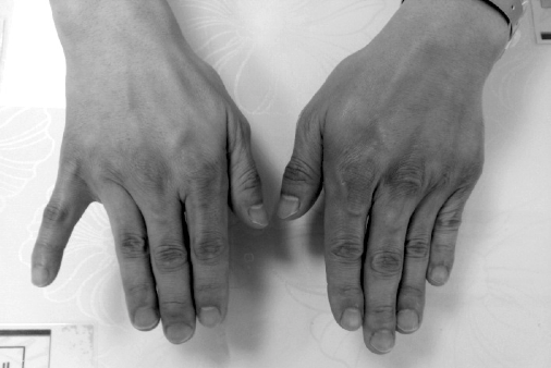 신경압박증후군(Nerve Compression Syndromes) - Metamedic