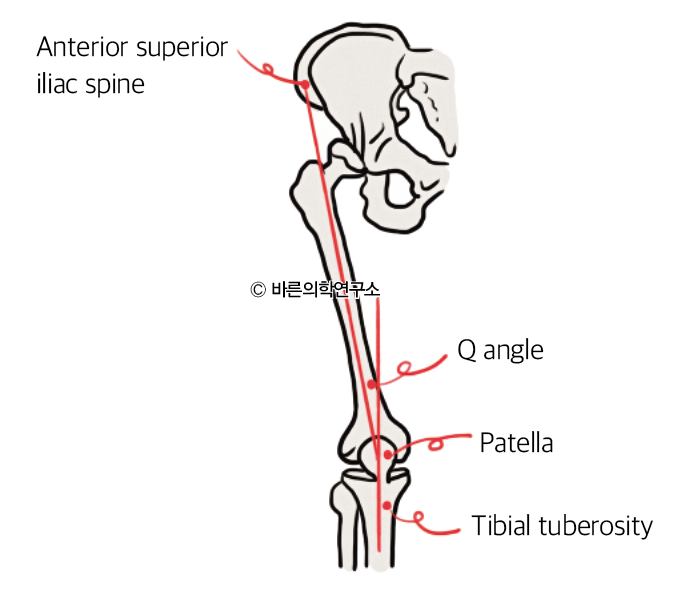 슬개대퇴 통증 증후군(Patellofemoral pain syndrome, PFPS) - Metamedic