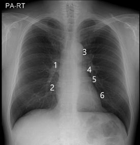 가슴 X선 - Metamedic