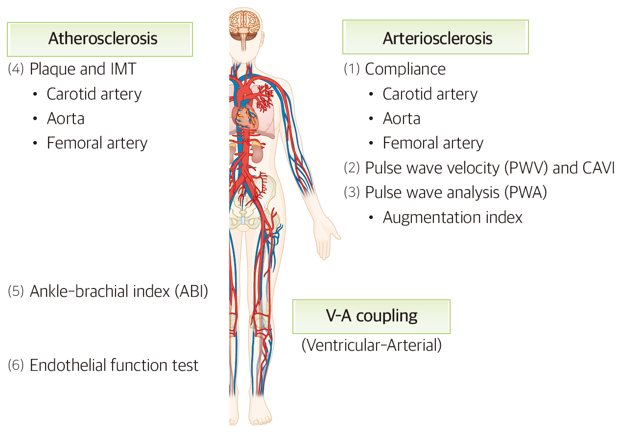 동맥경화검사(Arterial Stiffness Tests): PWV, 경동맥 내중막 두께 - Metamedic