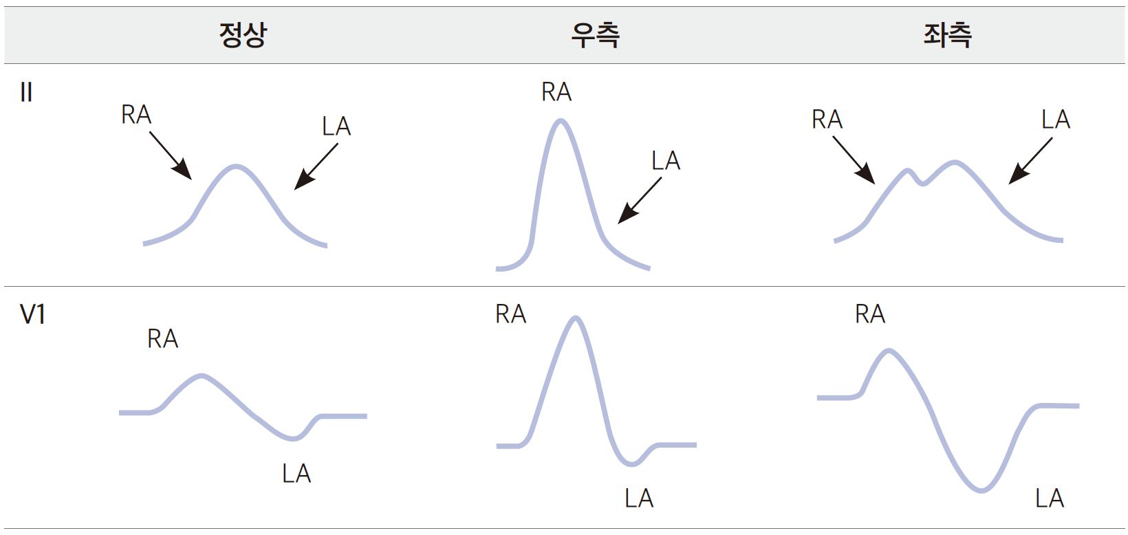 심전도 검사 - Metamedic