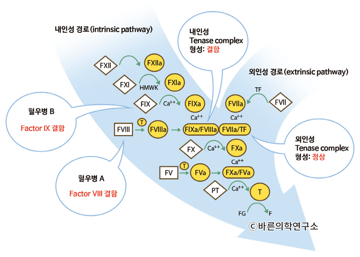 출혈에 대한 접근 - Metamedic
