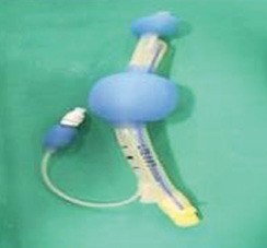기도유지기: 성문외 기도기(extraglottic airway): Non-Laryngeal Mask Airway ...