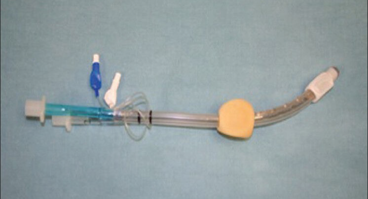기도유지기: 성문외 기도기(extraglottic airway): Non-Laryngeal Mask Airway ...