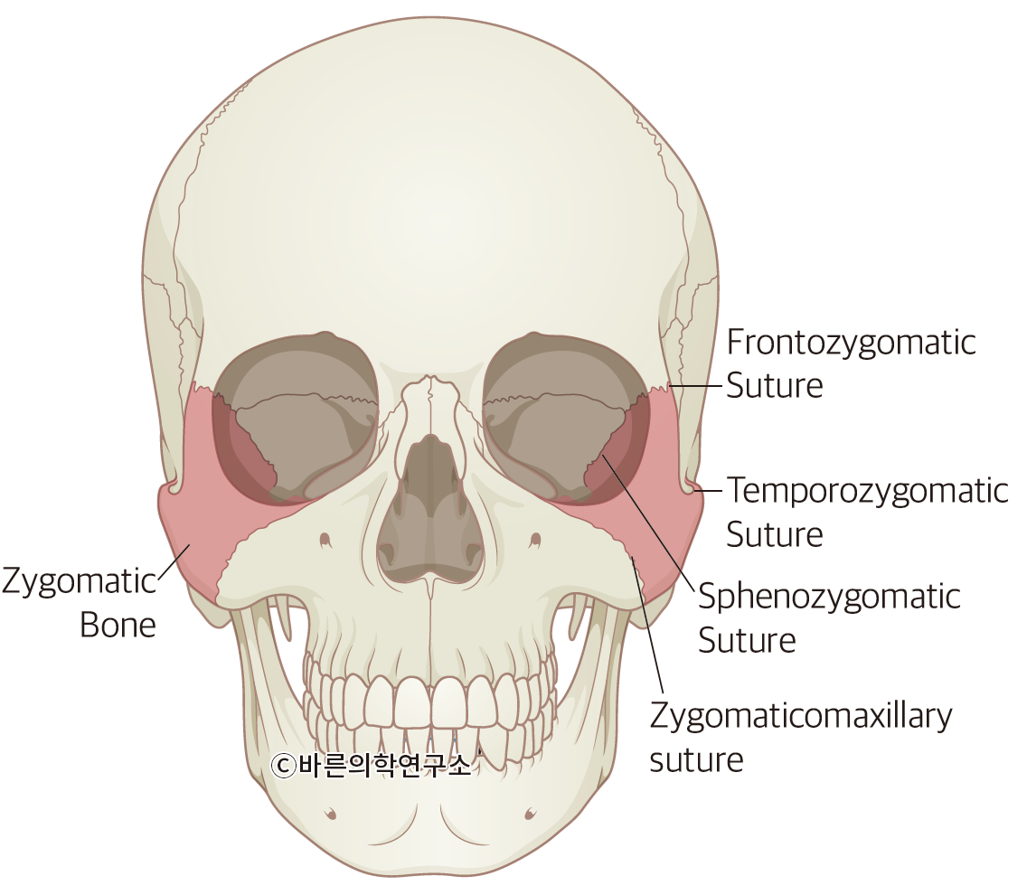 중간 얼굴 부위 골절(mid-face fracture): 광대뼈 골절 - Metamedic