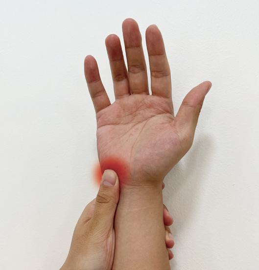 삼각 섬유연골 복합체 손상(Triangular fibrocartilage complex tear) - Metamedic