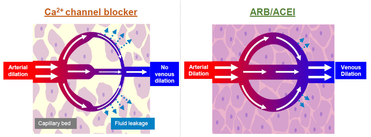 칼슘통로차단제(Calcium channel blocker)의 부작용: 말초부종(peripheral edema) - Metamedic