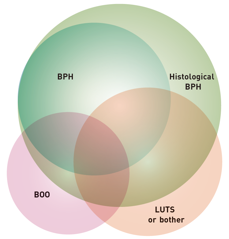 하부요로증상/배뇨장애 (Lower urinary tract symptoms/Micturition disorder) - Metamedic