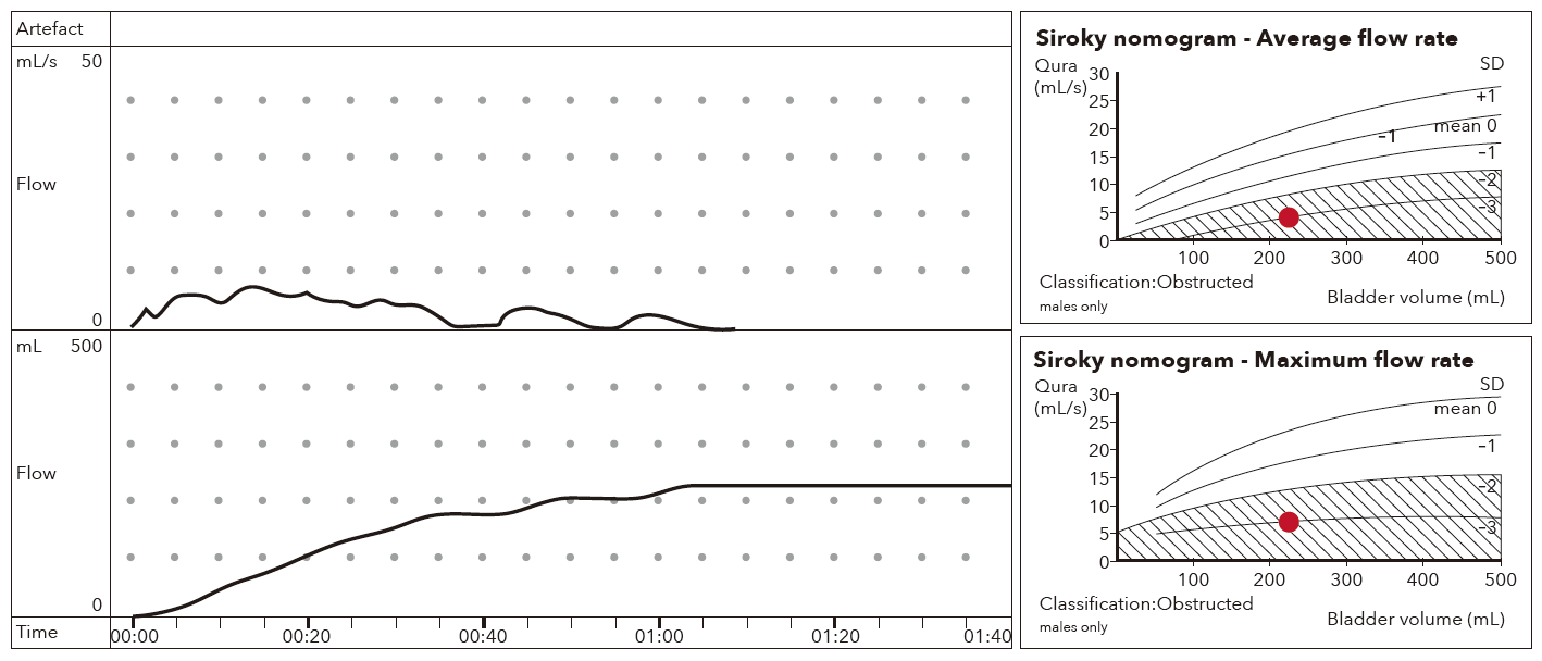 전립선비대증 (Benign prostatic hyperplasia, BPH) - Metamedic