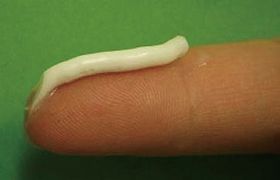 국소 스테로이드: 사용의 실제 - Metamedic