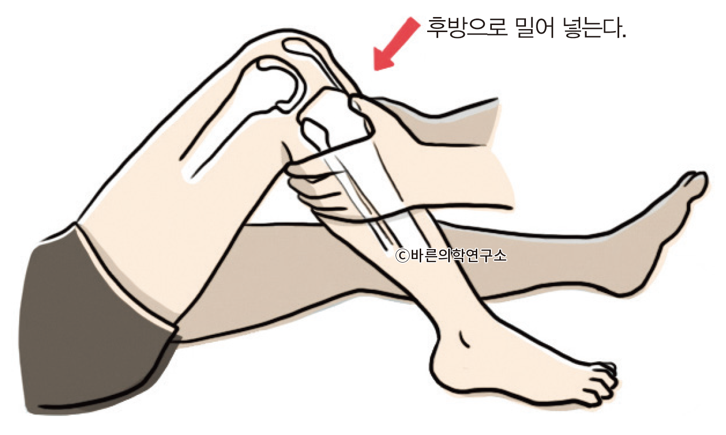 무릎 통증(Knee pain) - Metamedic