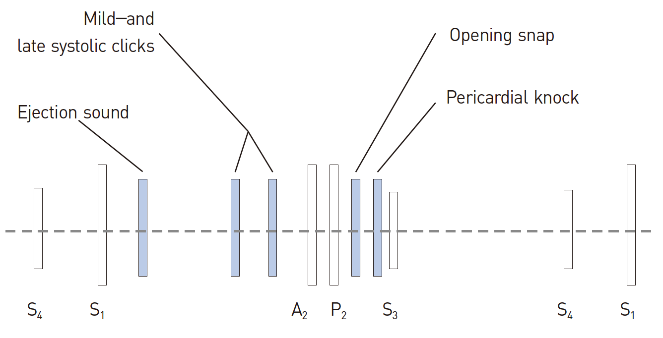심잡음(Heart murmur) - Metamedic